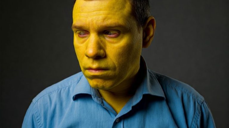 Boererate Vir Geelsug: Wat Jy Moet Weet