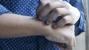 Boererate Vir Omlope: Natuurlike Wenke En Behandeling Vir Ringwurm